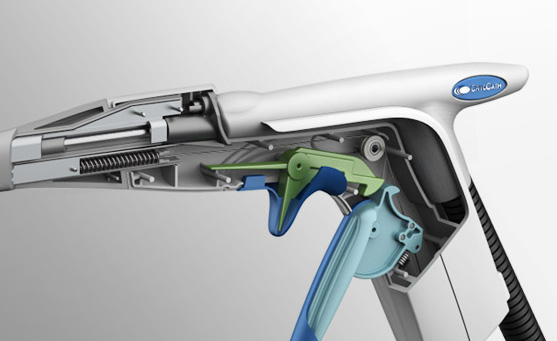 Medical Device Design: Building Adaptable CAD Databases-How & Why